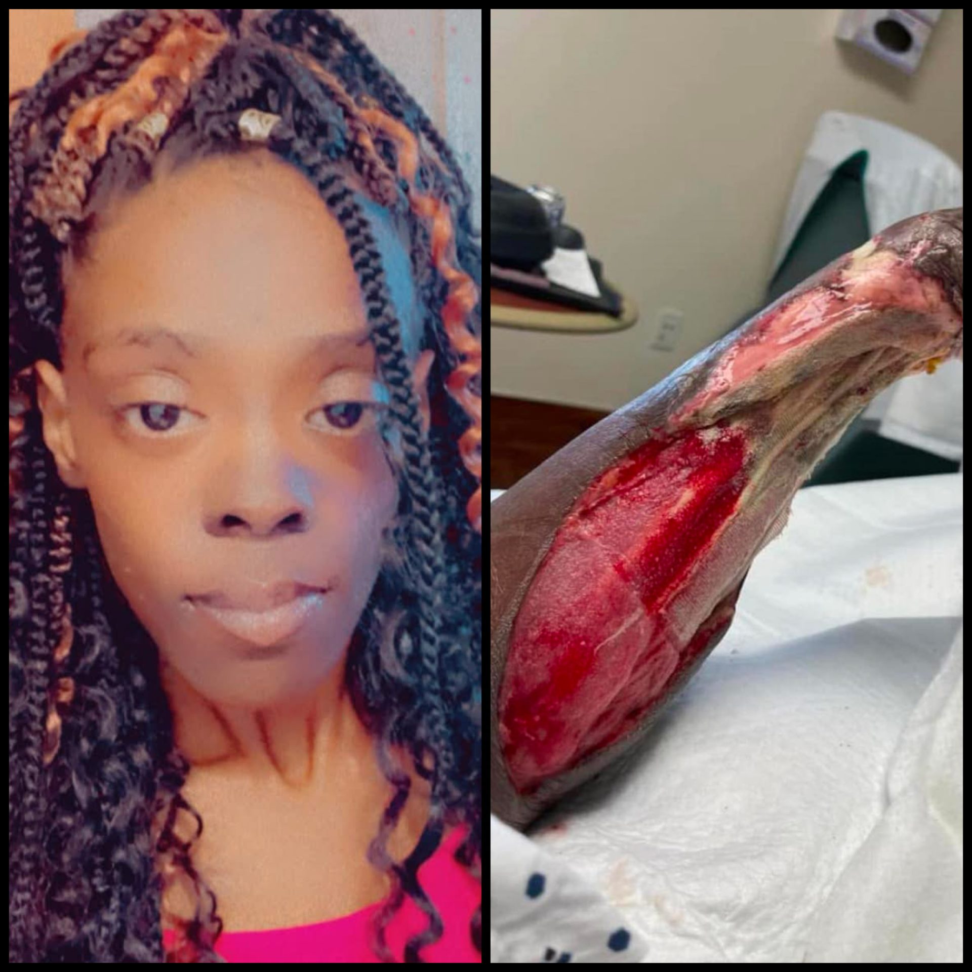 Woman Calls Out ECU Health Over Treatment Of Patient